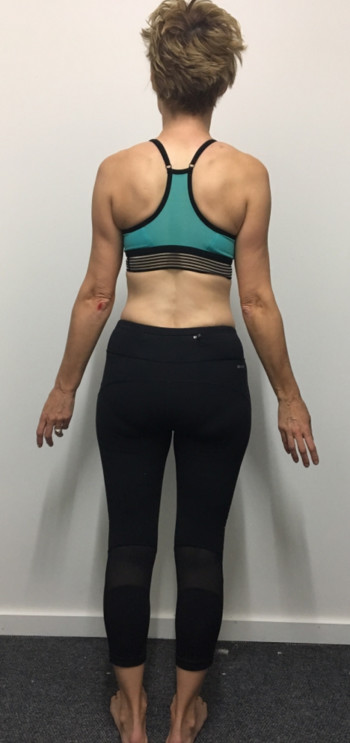 Best Personal Trainers in Drummoyne | Vision PT