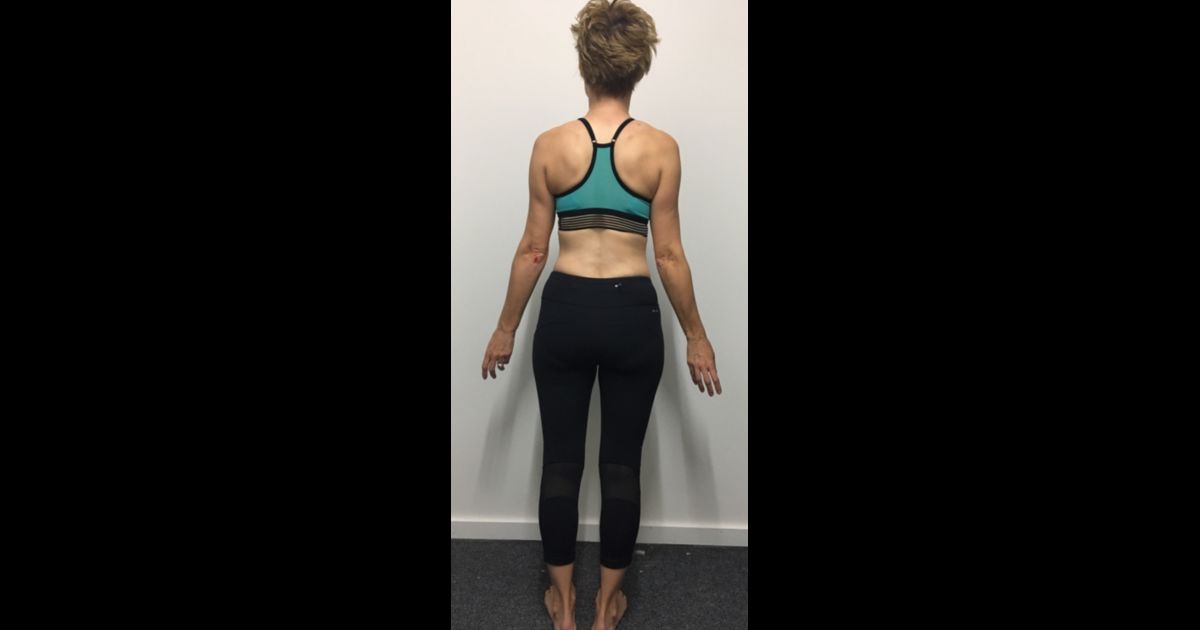 Philippa Baker - Success Story - Drummoyne | Vision PT